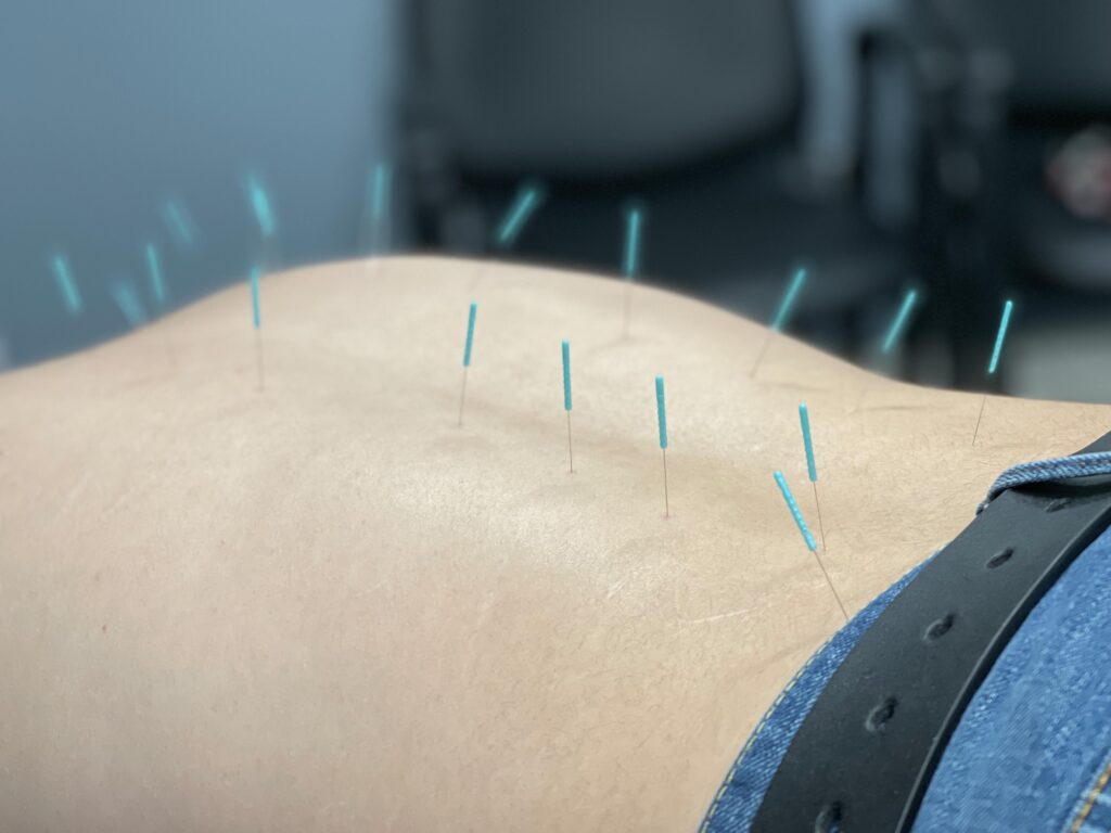 Chiropractic, Acupuncture & Massage - Carlin Chiropractic - Lenexa